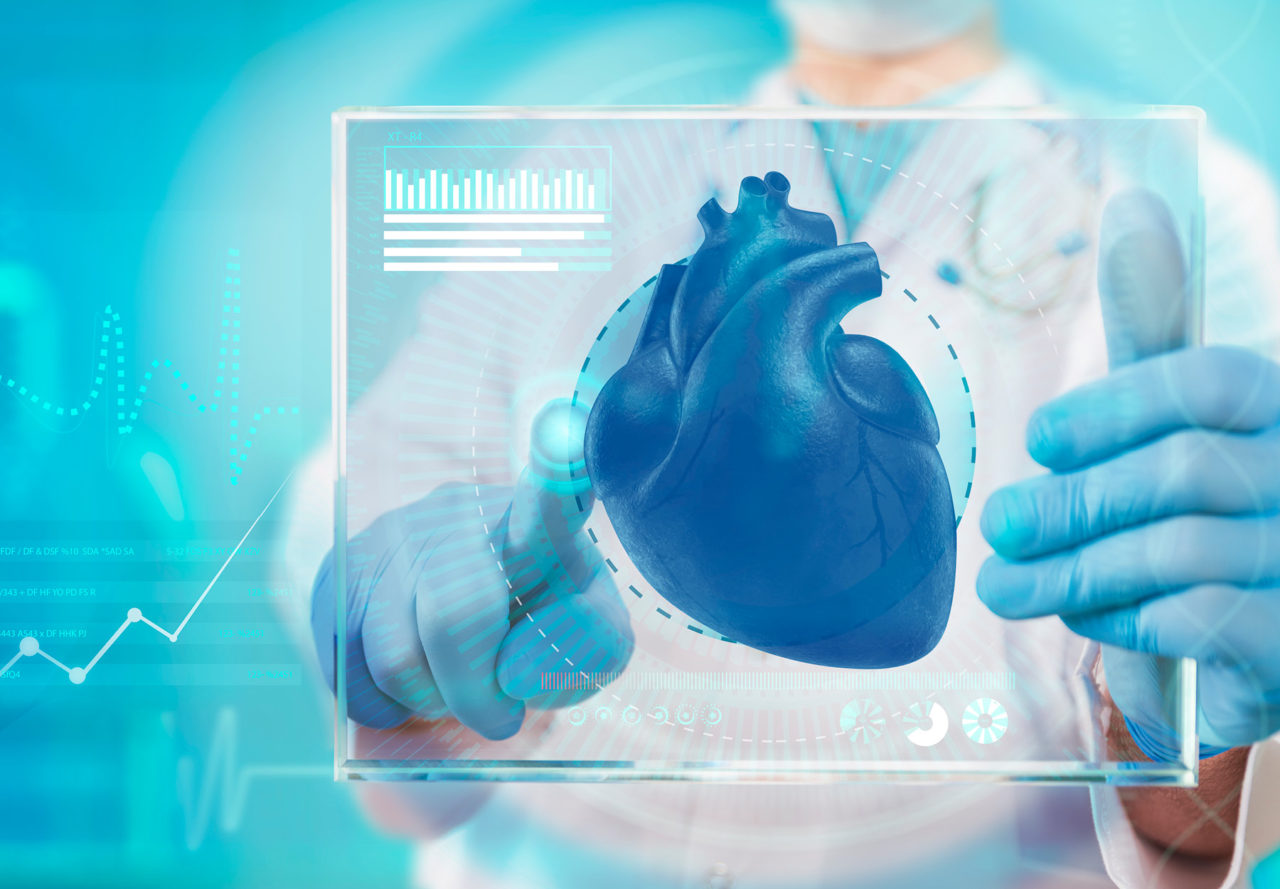 Polygenic Risk Scores Can Predict Chance of Sudden Cardiac Death - G2 ...