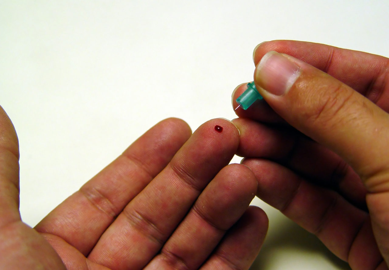 Arrayit President Convicted of Silicon Valley Blood Testing Scam - G2 ...