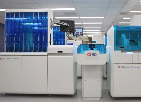 Lessons Learned from a Total Laboratory Automation Project