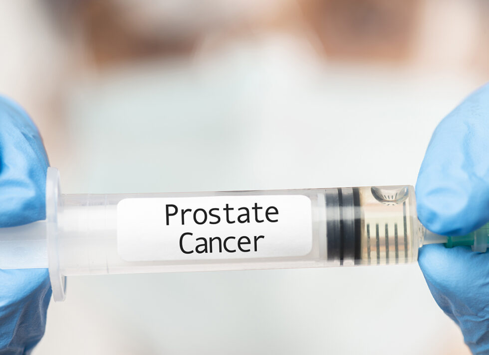Diagnostics Pipeline: MyOme and Artera Launch New Tests for Prostate ...